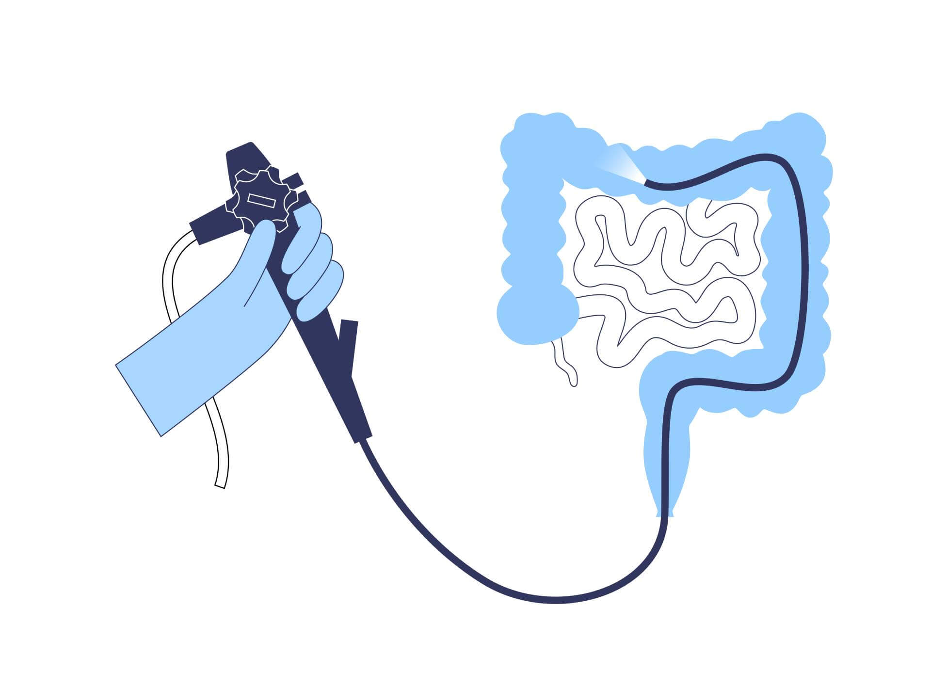 Flexible Sigmoidoscopy in Dallas, TX | DHAT